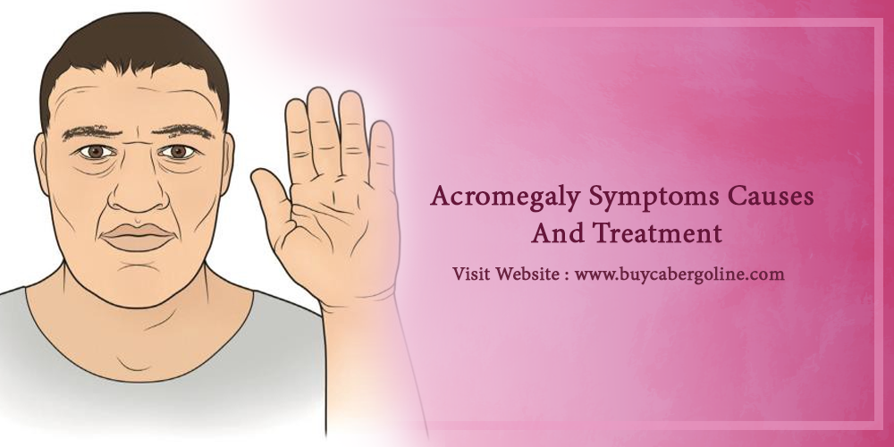 Acromegaly Symptoms Causes And Treatment 【Best Solution】-BC
