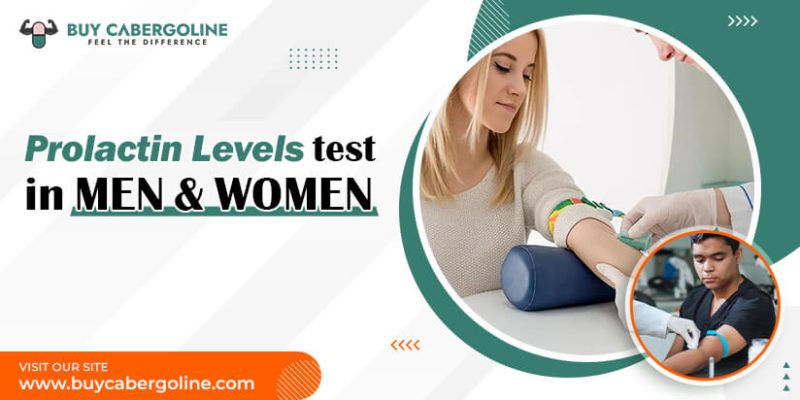 Prolactin Level Test In Men And Women【 Information 2021】-BC